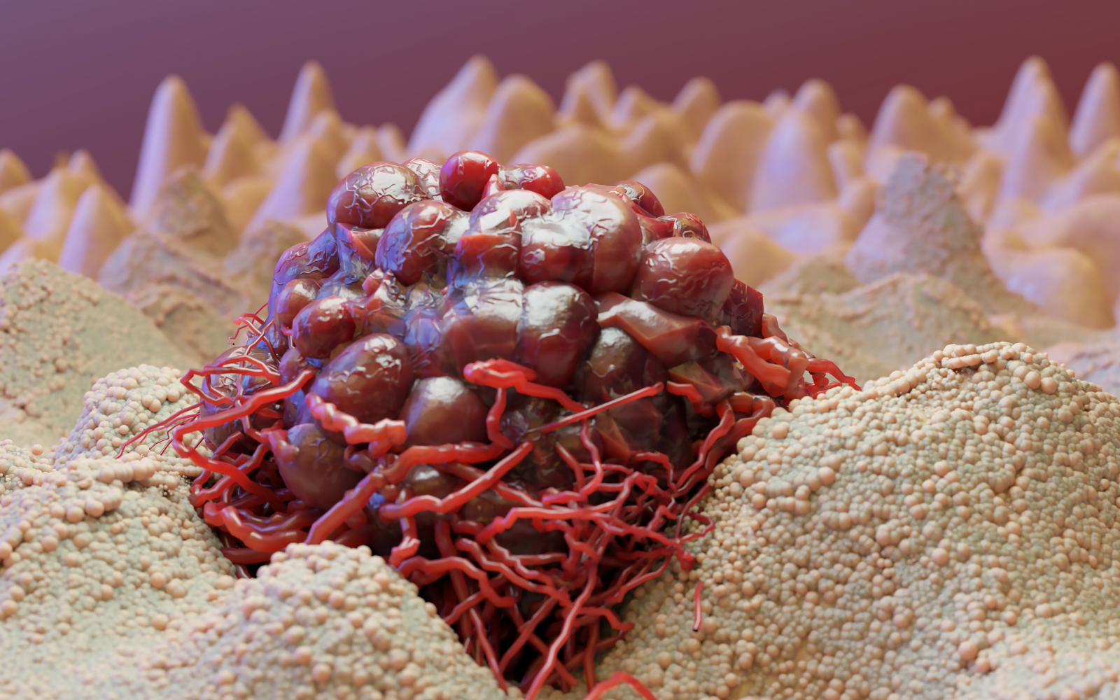 BMS Presents 10-Year Follow-Up Data from CheckMate -067 Showing ...