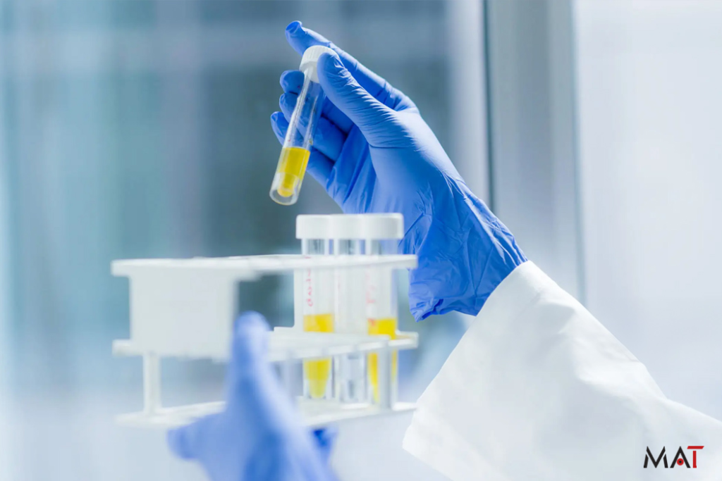 Lundbeck Showcases Breakthrough in Epileptic Seizure Reduction with ...